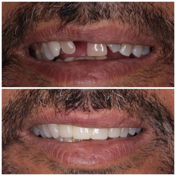 Protesis dental y Rehabilitación Maxilofacial - The Dental Clinic